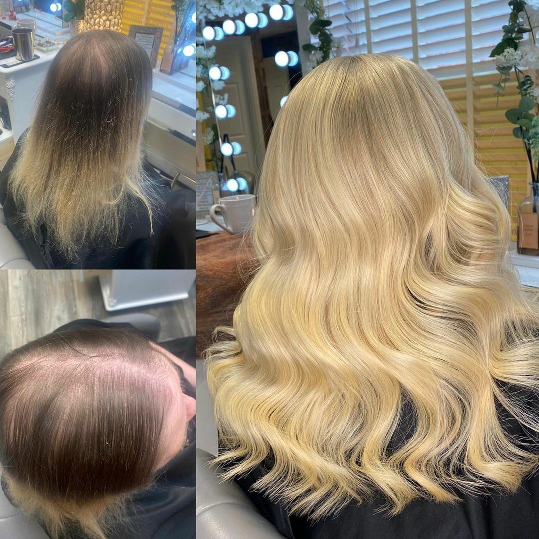 Hot Selling | Skin Base Hair Topper With 4 Clips In Silk Top Virgin Eu